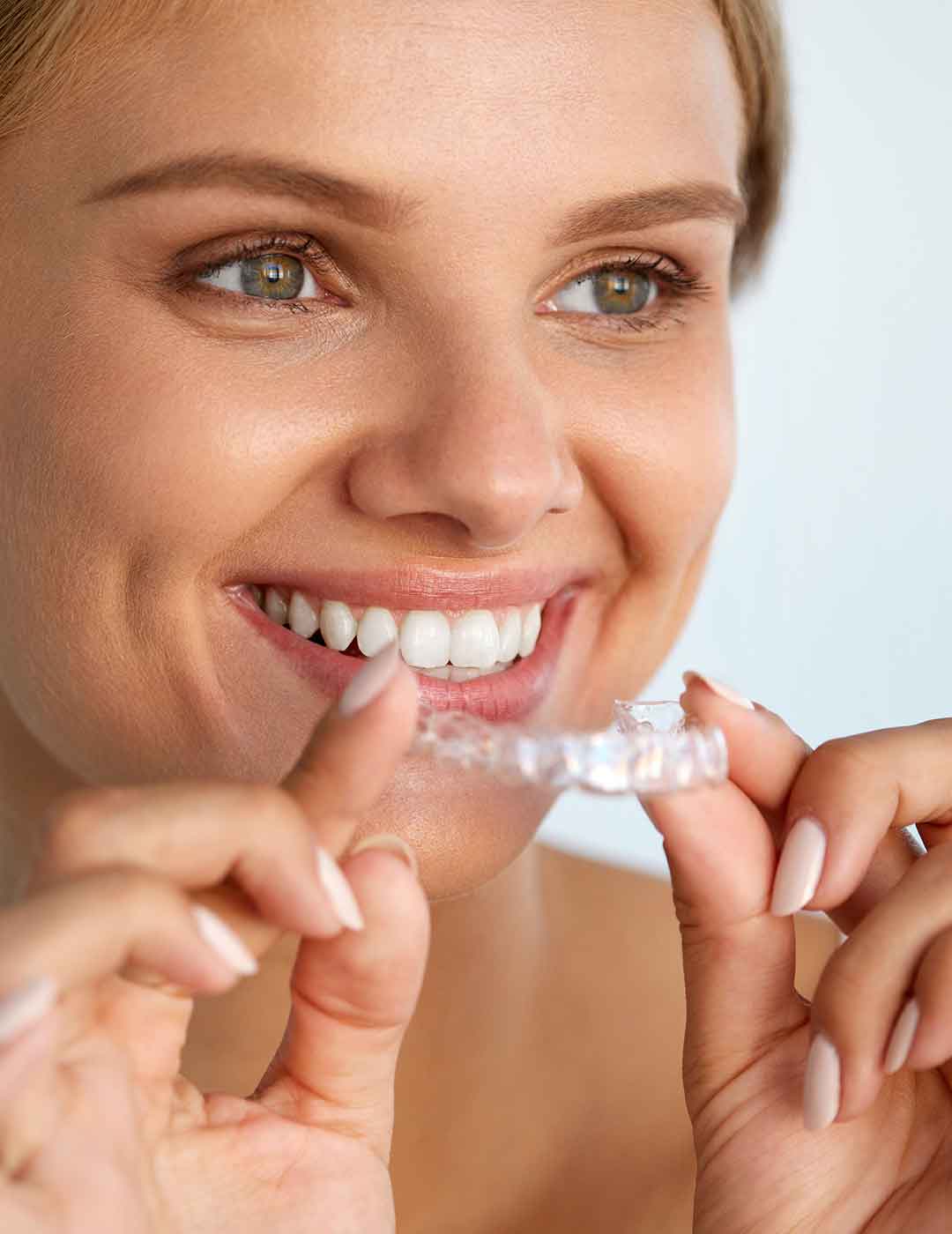 Invisalign® Rancho Bernardo & 4S Ranch | DSR Dental